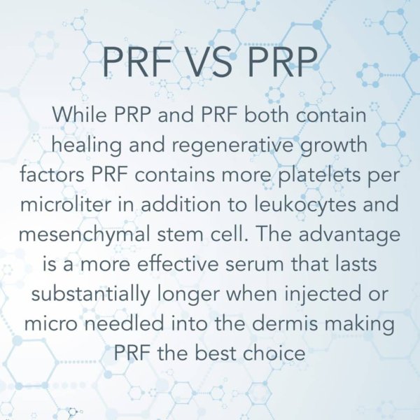 PRP Platelet-Rich Plasma / PRF Platelet-Rich Fibrin