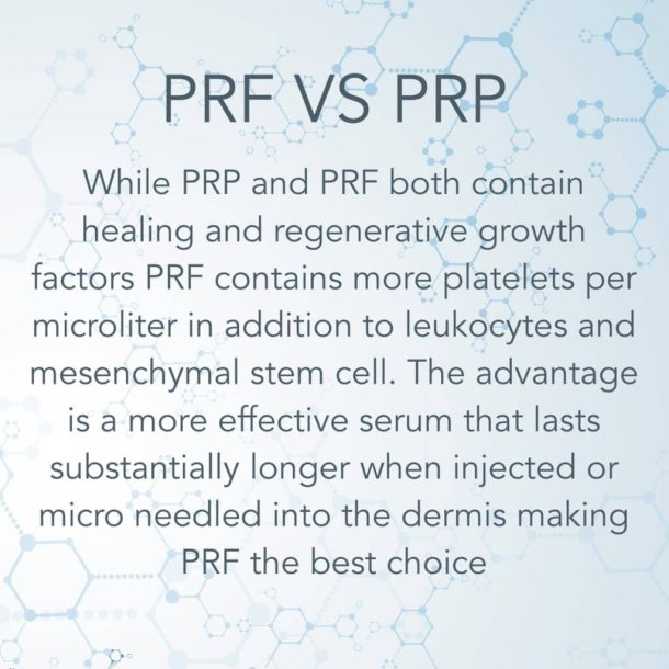 PRP Platelet-Rich Plasma / PRF Platelet-Rich Fibrin